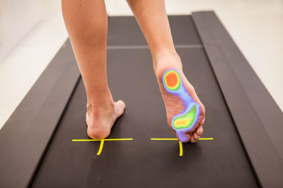 Estudio de la pisada - ORTOPEDIA LLORET SALUT